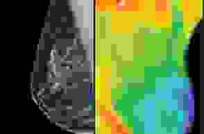 Professionals | Therma-Scan