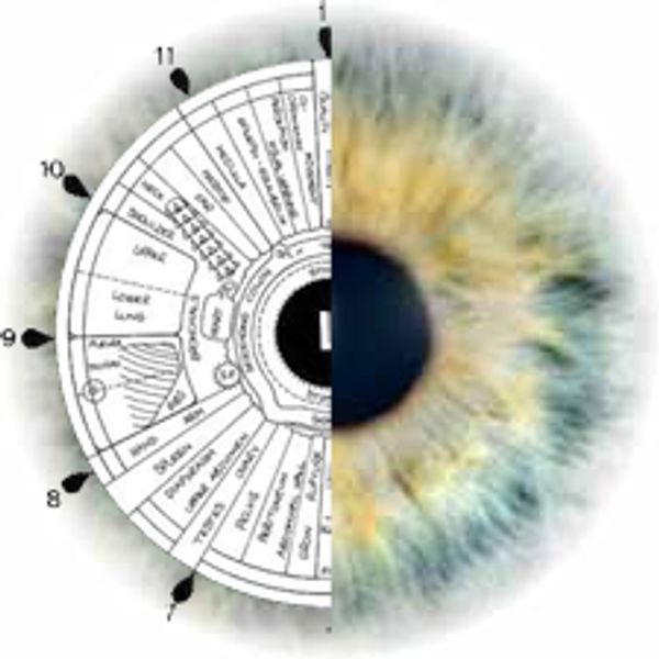 Book Classes | Iridology Life