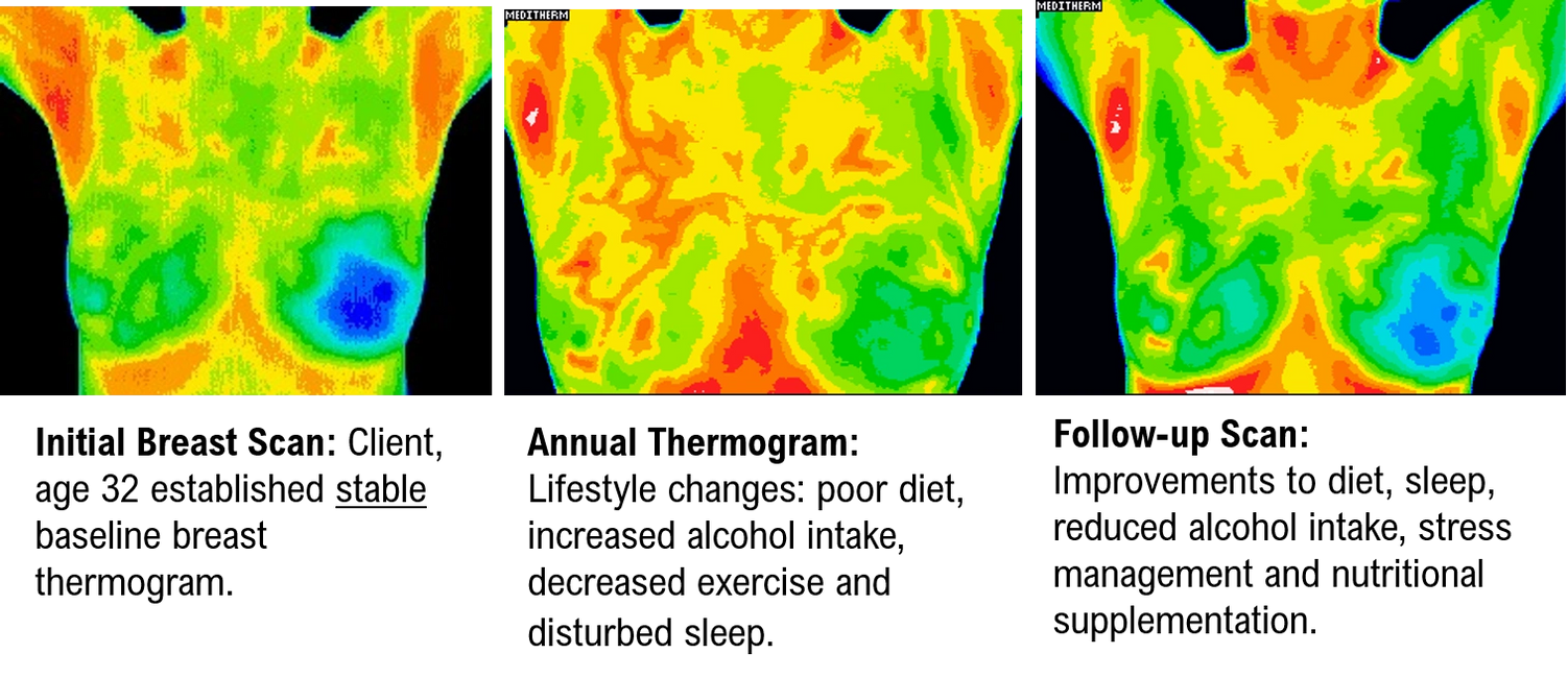 Diagnostic Imaging - East Valley Thermography | East Valley Thermography