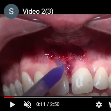 PeriAcryl | Surgical Solutions