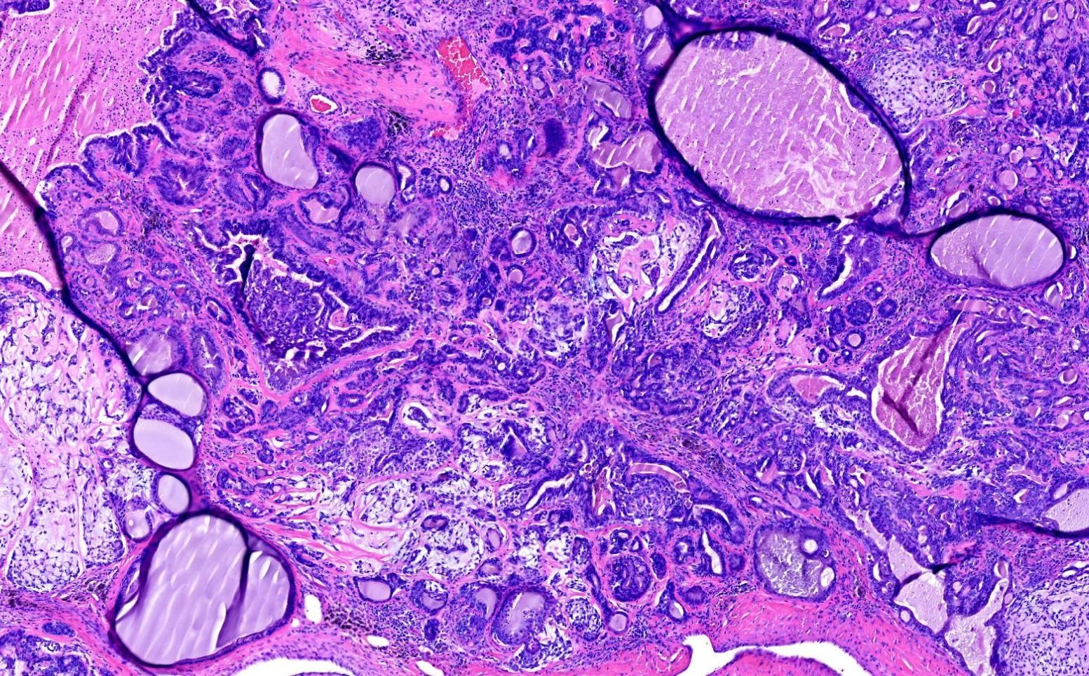 Sebaceous Adenitis | Florida Vet Path, Inc.