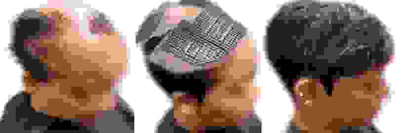 The Weave Buddy - Scalp Protectors, Hair Extensions, Weave | The Weave ...