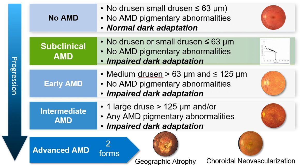 AMD 黃斑 Nutrition Genetics | http://dralbertng2010eye.com/