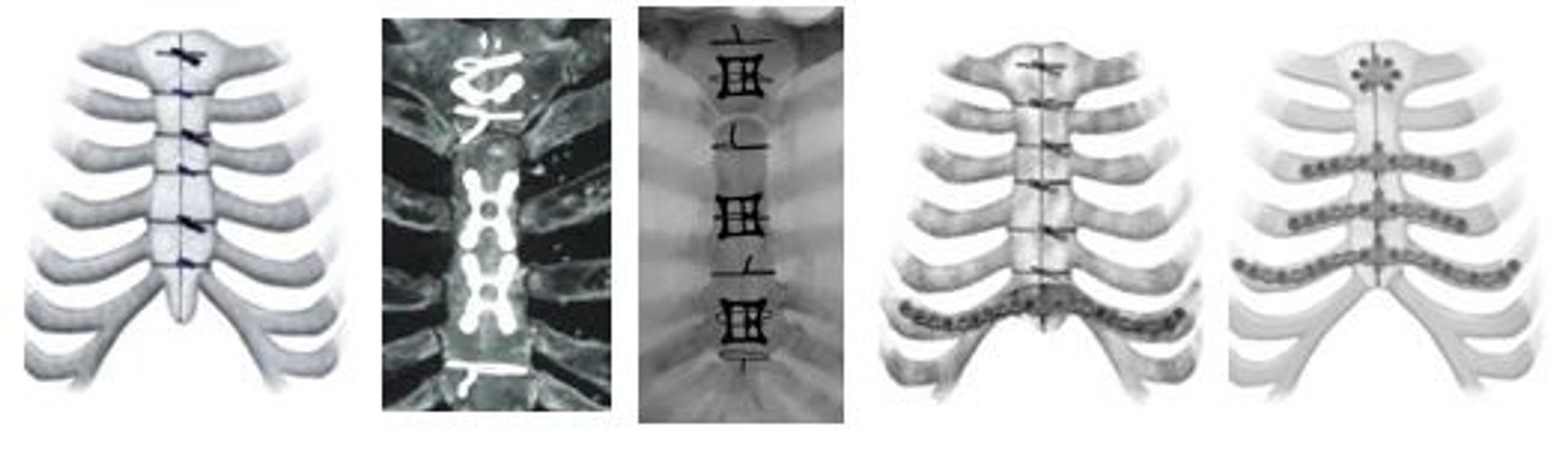 CircumFix Solutions, Inc